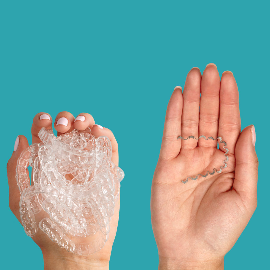 InBrace | Hidden Braces On Autopilot | Veil & Wild Orthodontics